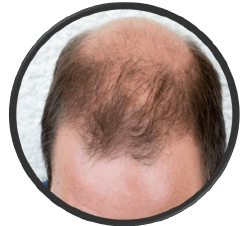 Hair Care - Fortune One
